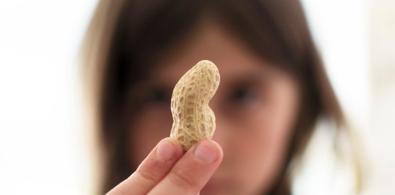 A couple of hives does not a peanut allergy make - Allergy ...