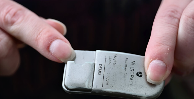 Brain stimulation chip gives patient her life back - Medical Republic