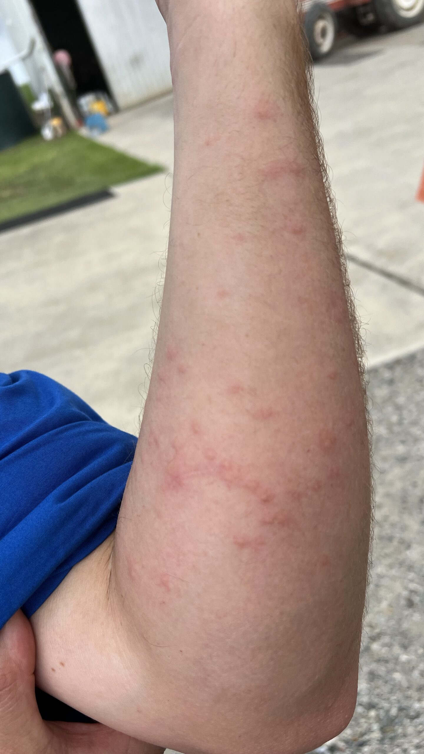 We have to stop red imported fire ants - Medical Republic
