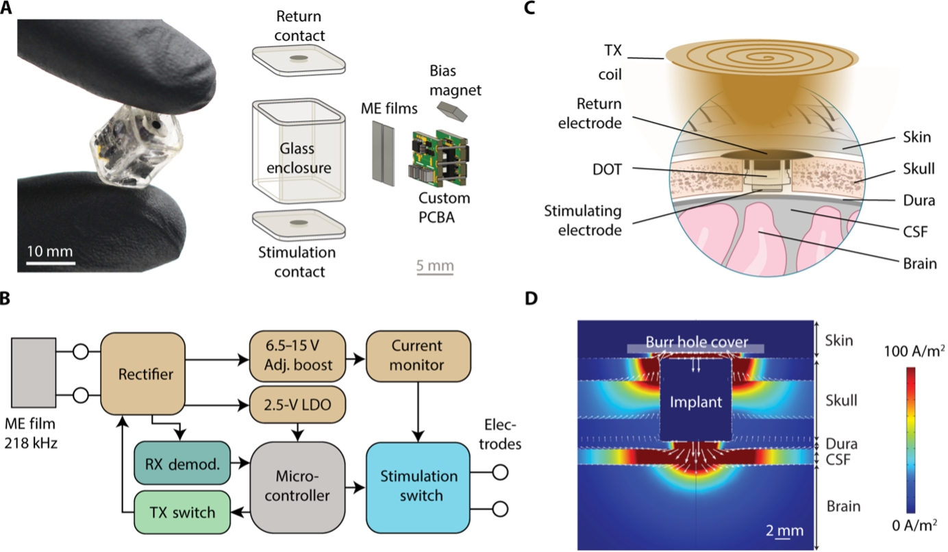 Remote-control your brain with this tiny implant - Medical Republic
